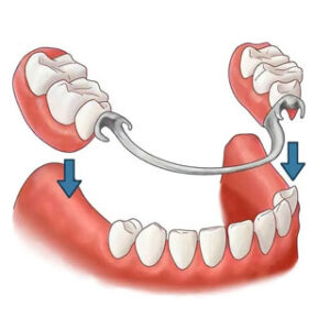 Comprehensive Dental Services | Dental Design Smile in Miami