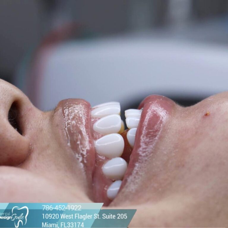 Gallery - Dental Design Smile