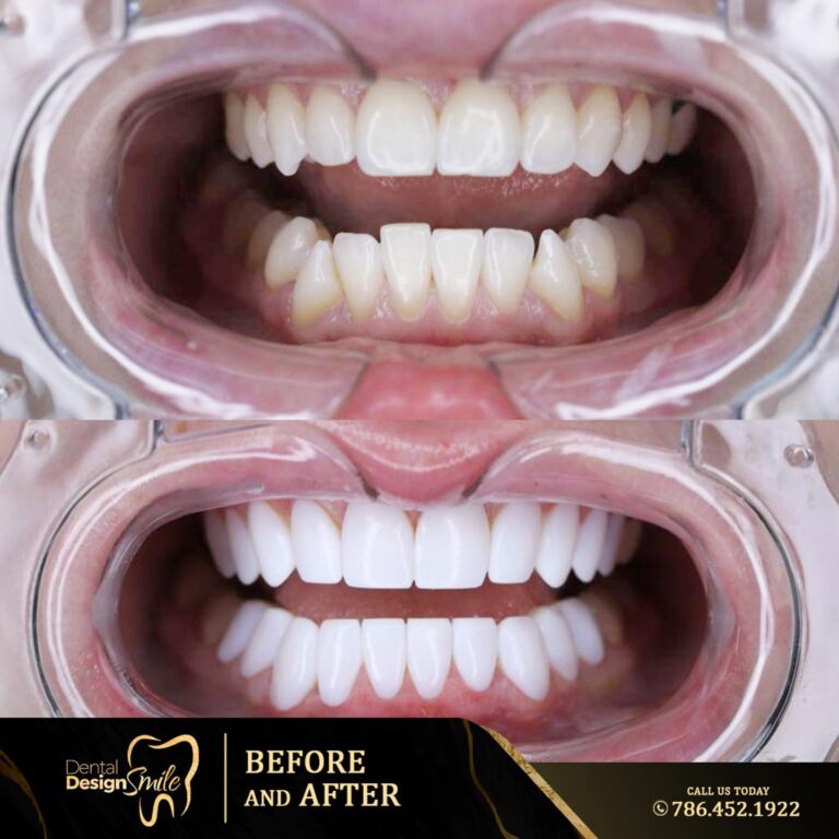 Gallery - Dental Design Smile